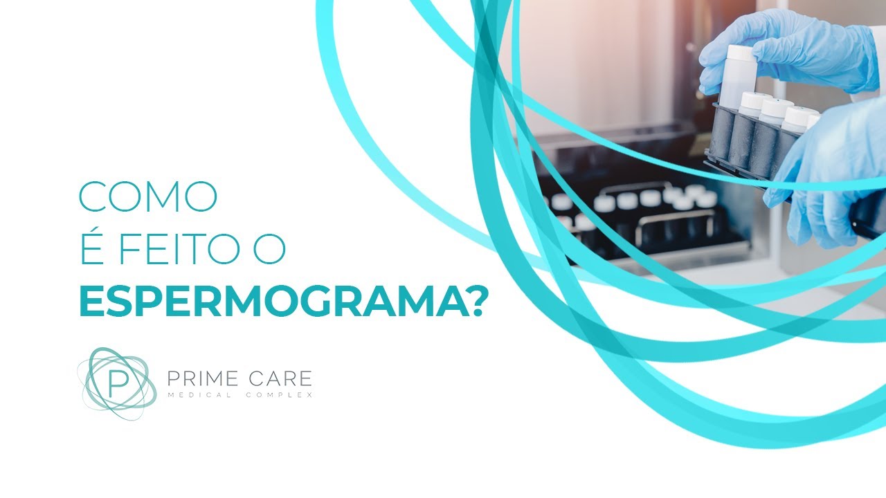 Como é feito o Espermograma ou Análise do Esperma? Dr. Fábio Tanno ...