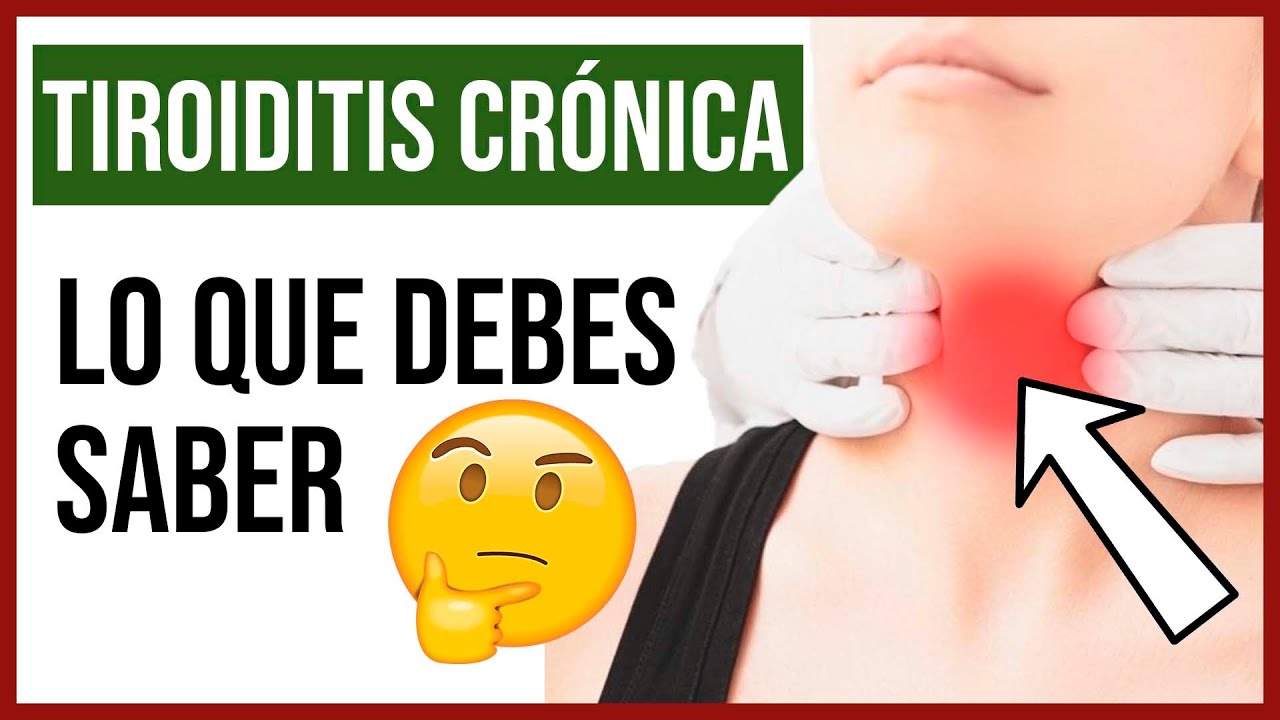 Si tienes estos SÍNTOMAS 💥 Podría ser Tiroiditis de Hashimoto ...