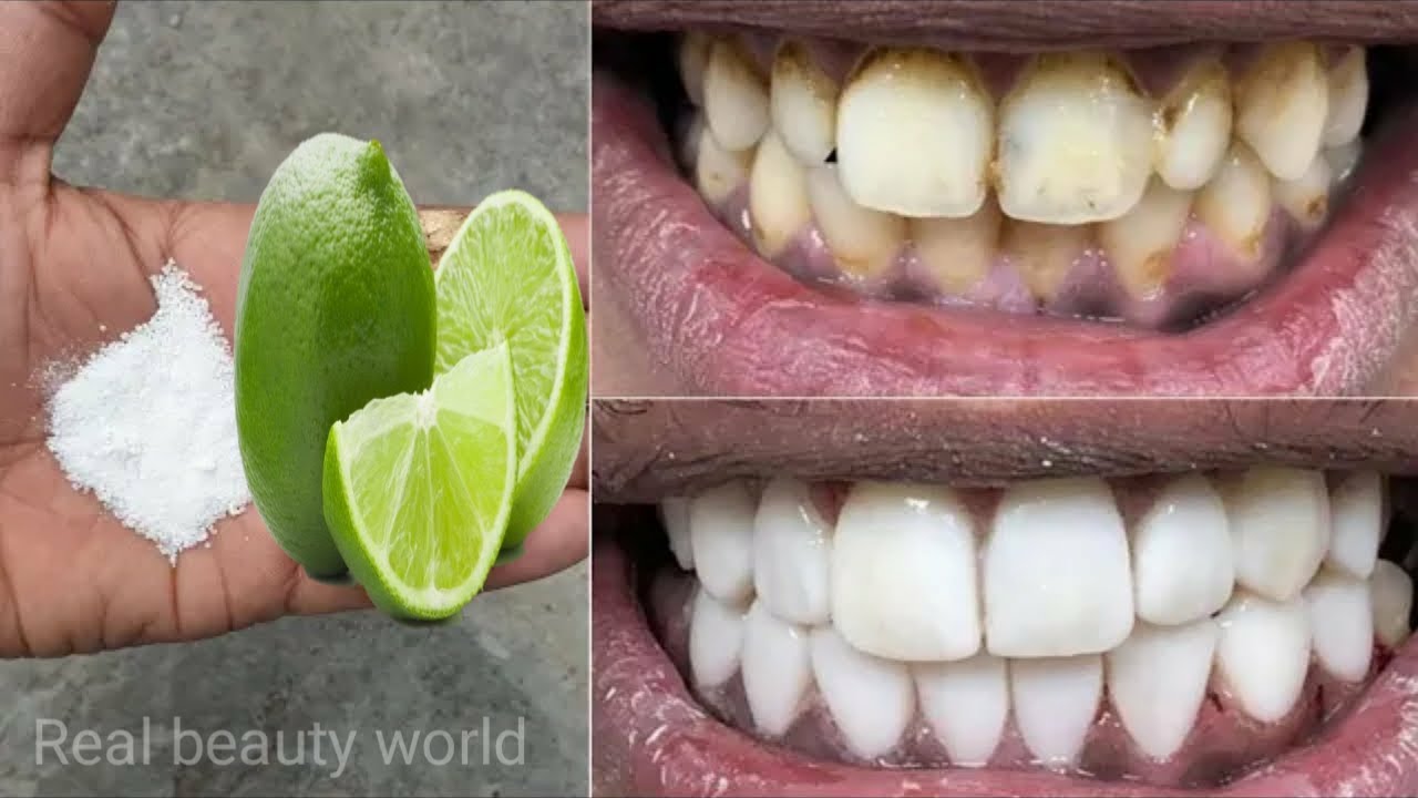 Whiten teeth in less than 2 minutes -Teeth will be shiny and shiny-Real ...