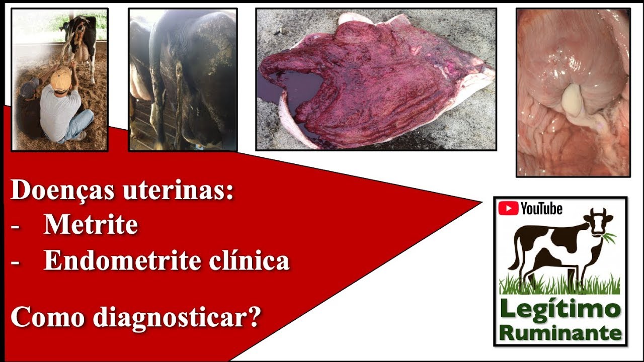 Doenças Uterinas: Metrite e Endometrite Clínica - YouTube
