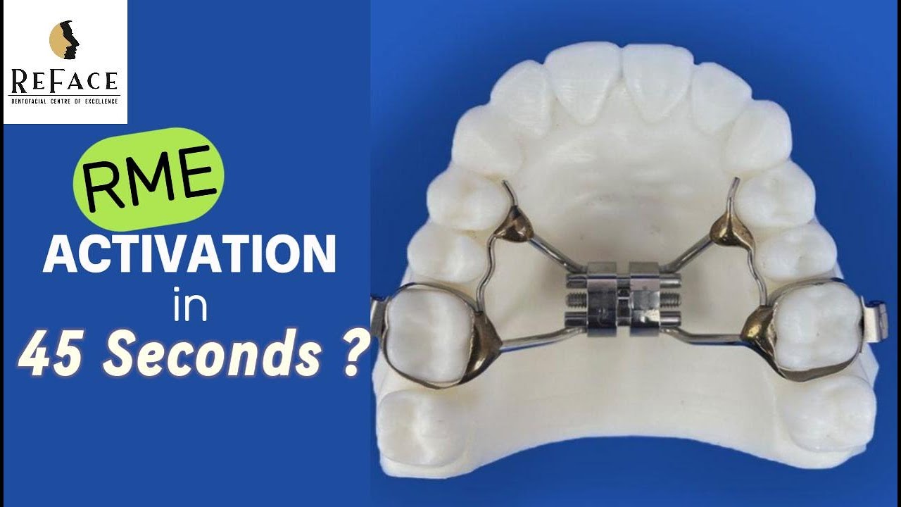 Unlock Your Perfect Smile: Easy RME Activation Guide! - YouTube