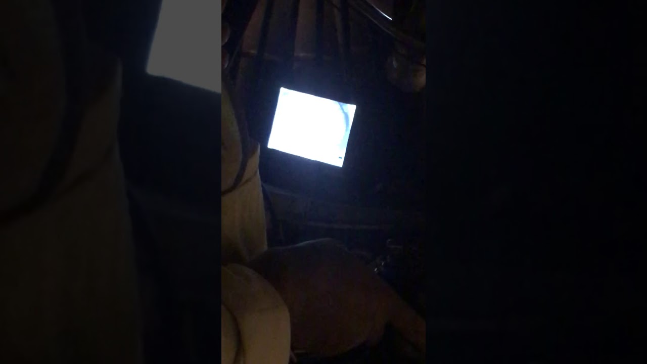 Borescope Inspection / CFM56-5B Engine - YouTube