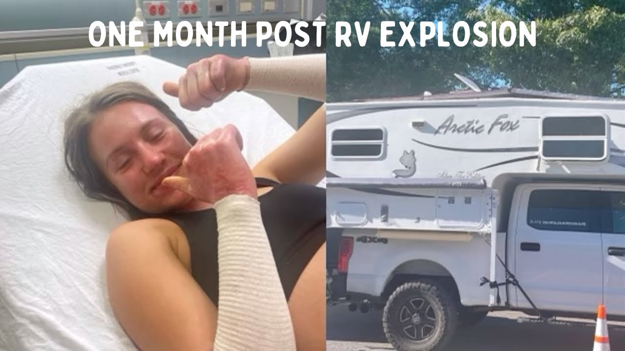 DANGERS OF RV LIVE | HOW AM I | ONE MONTH POST CAMPER EXPLOSION - YouTube