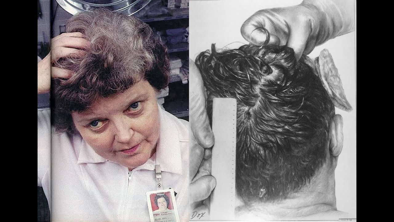 Nurse Doris Nelson's Reaction to JFK Autopsy Photo (March 2, 1981) - YouTube