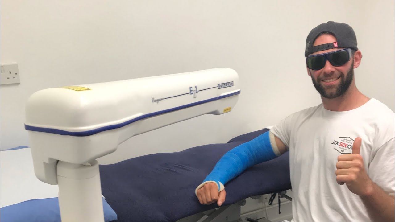 I Broke my Arm... what Rehab did I do to speed it up???? - YouTube