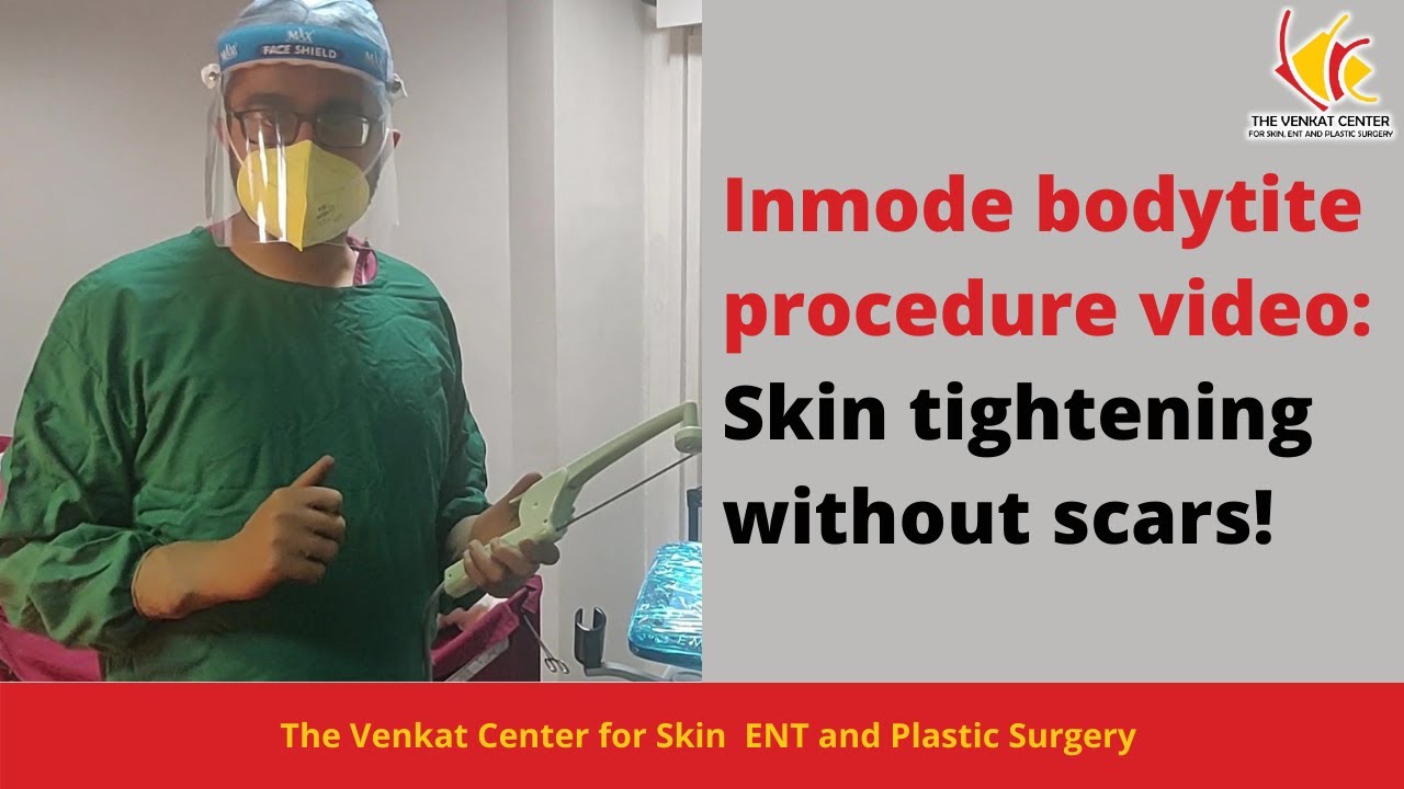 Skin Tightening with InMode: How it Works? Explained fully through ...