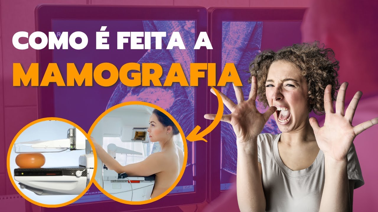 Como o exame de Mamografia é realizado ? - YouTube
