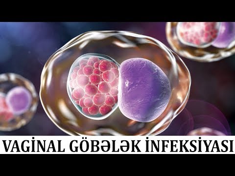 Vaginal göbələk infeksiyası NİYƏ yaranır?