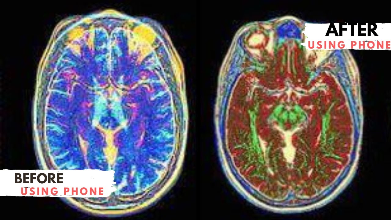 How Your Phone is Affecting Your Brain? - YouTube