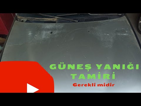 Güneş Yanığı Nasıl Düzelir? Boyasız Verniksiz düzelir mi? (Bilmeniz Gerekenler)