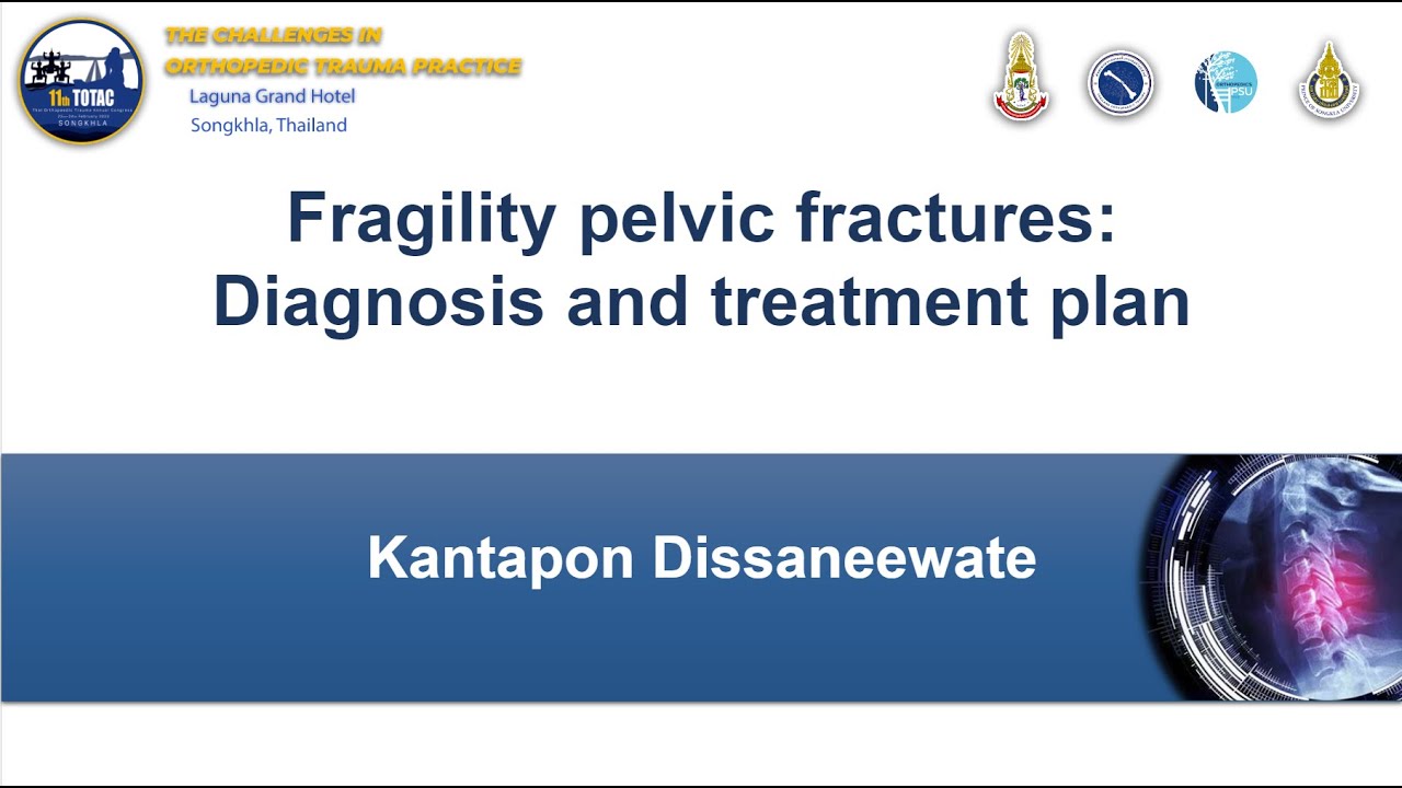 Fragility pelvic fractures: Diagnosis and treatment plan Dr.Kantapon ...