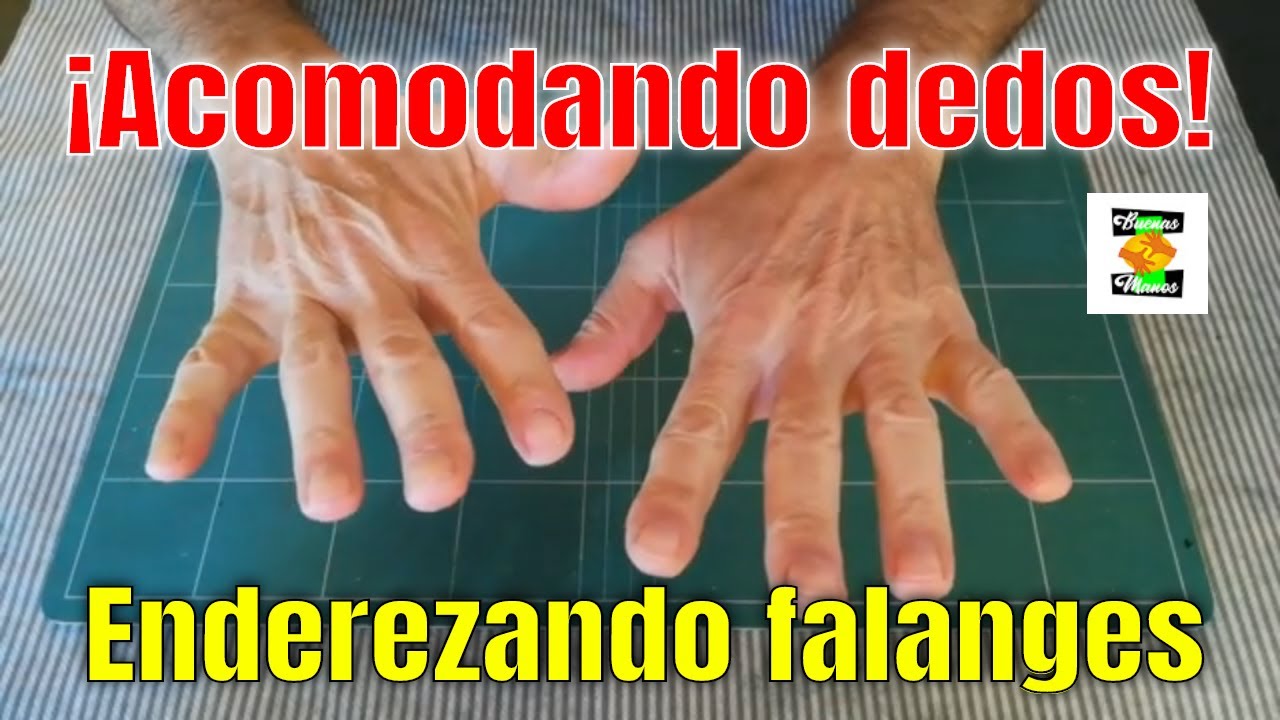 Como ACOMODAR Y ENDEREZAR LOS DEDOS de las manos - YouTube