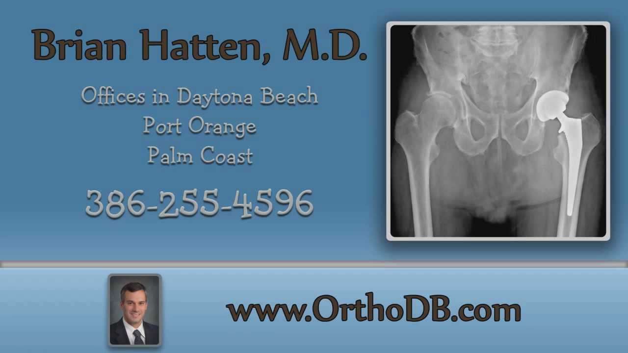 Anterior Approach Hip Replacement - Brian Hatten, M.D. - YouTube