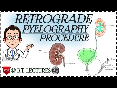 #Retrograde Pyelography Procedure #Retrograde Pyelogram # Indications ...