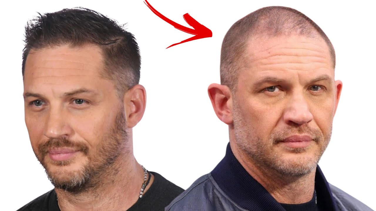 Tom Hardy Is Going Bald Fast - YouTube