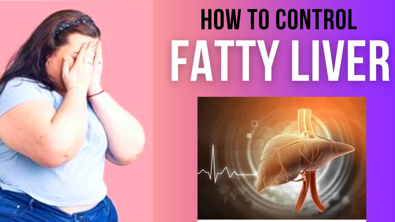How To Improve Fatty Liver | Fatty Liver Treatment | Fatty Liver Diet ...
