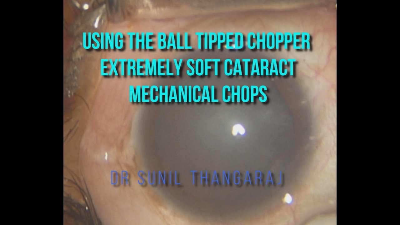 Mechanical horizontal chops with a long ball tipped chopper in an ...