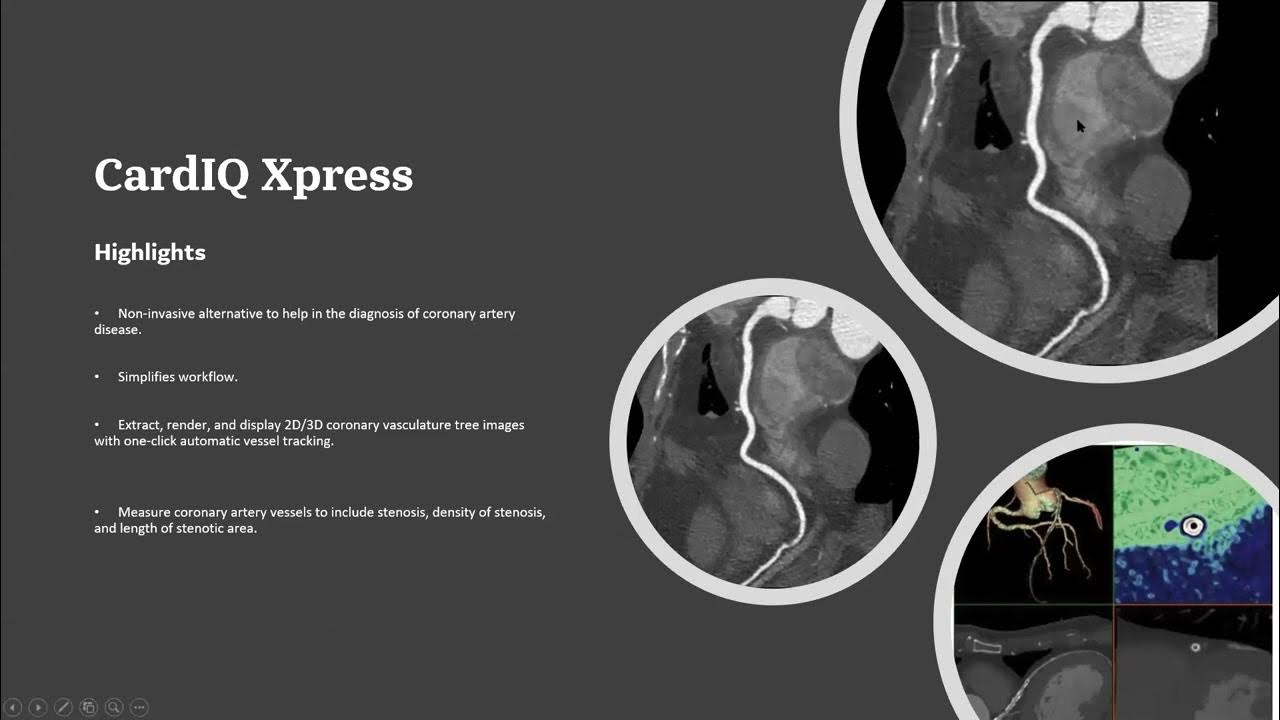 Module 4 Post Processing - Webinar Multislice CT - YouTube