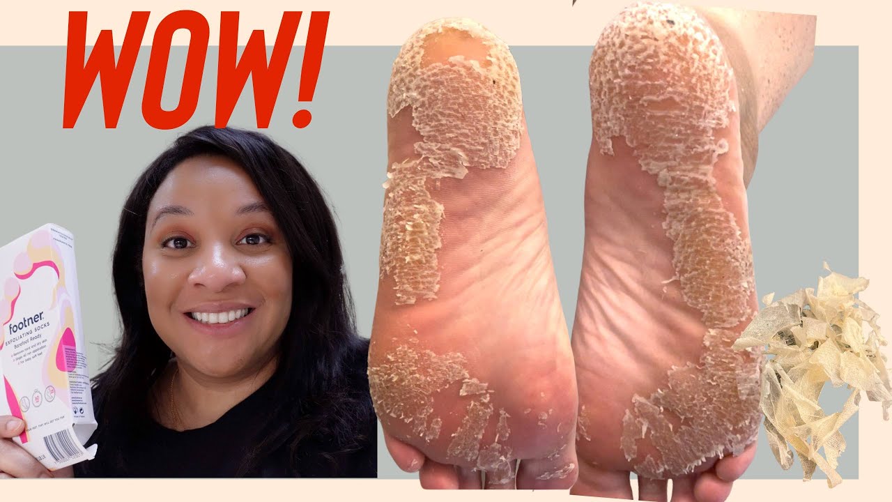 Testing Footner The Foot Peel Socks Youtube