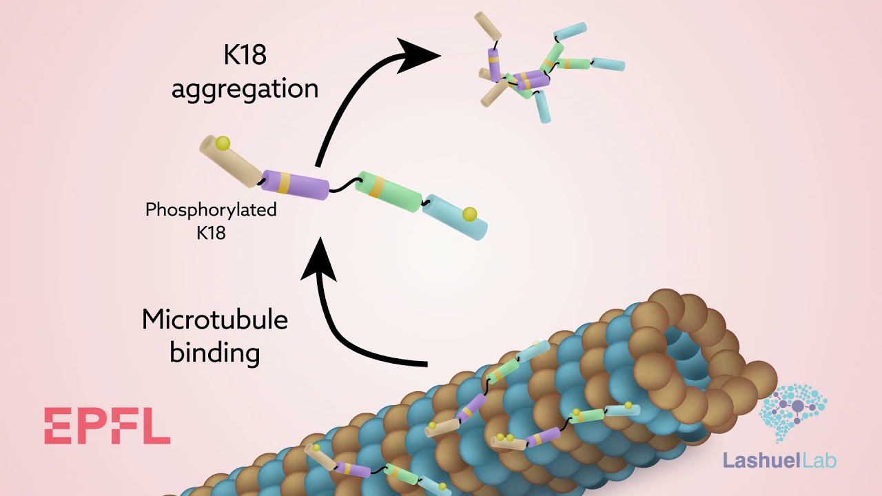 Tau Protein Phosphorylation