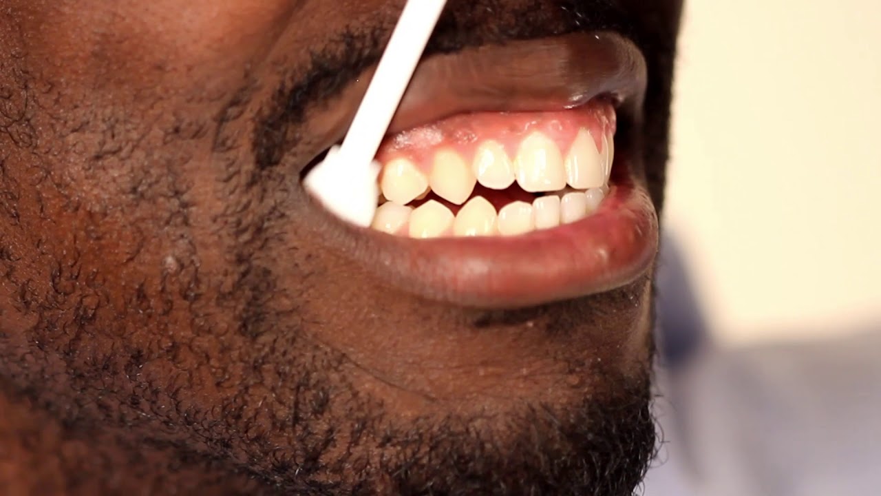 Aware™ Oral HIV Self-Test from Calypte Biomedical - YouTube