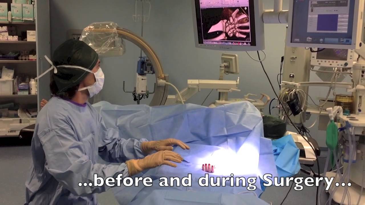 Leap Motion with Osirix Dicom Viewer in Operating Room with 3D CT Scan ...