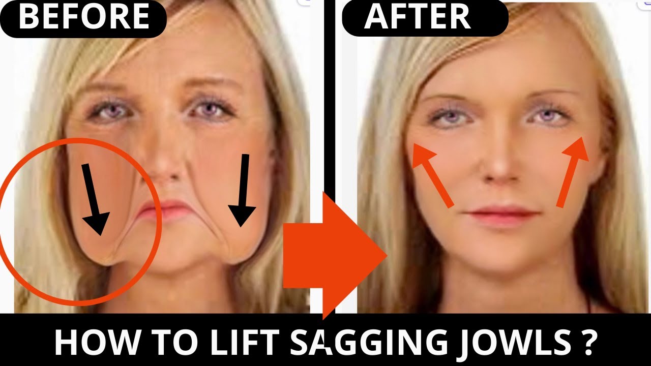 🛑 ANTI-AGING FACE LIFTING EXERCISES FOR JOWLS, SAGGY SKIN, CHEEKS, LIFT ...