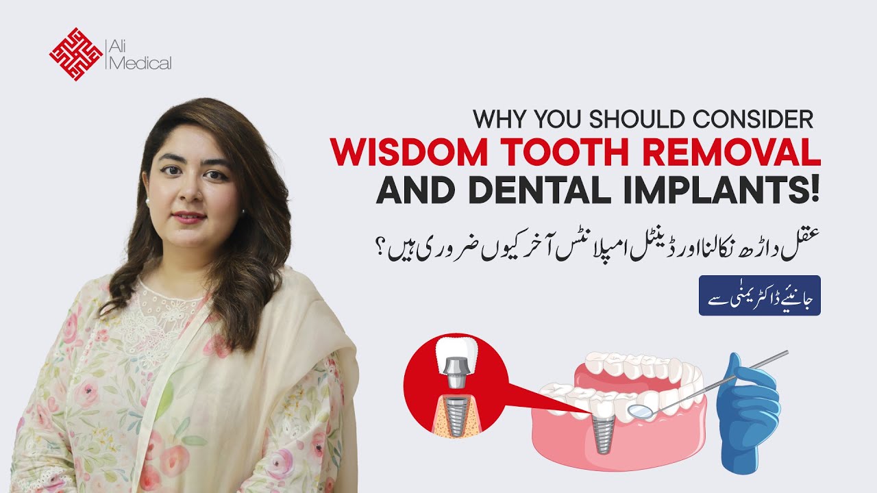 Why You should Consider Wisdom Tooth Extraction and Dental Implants ...