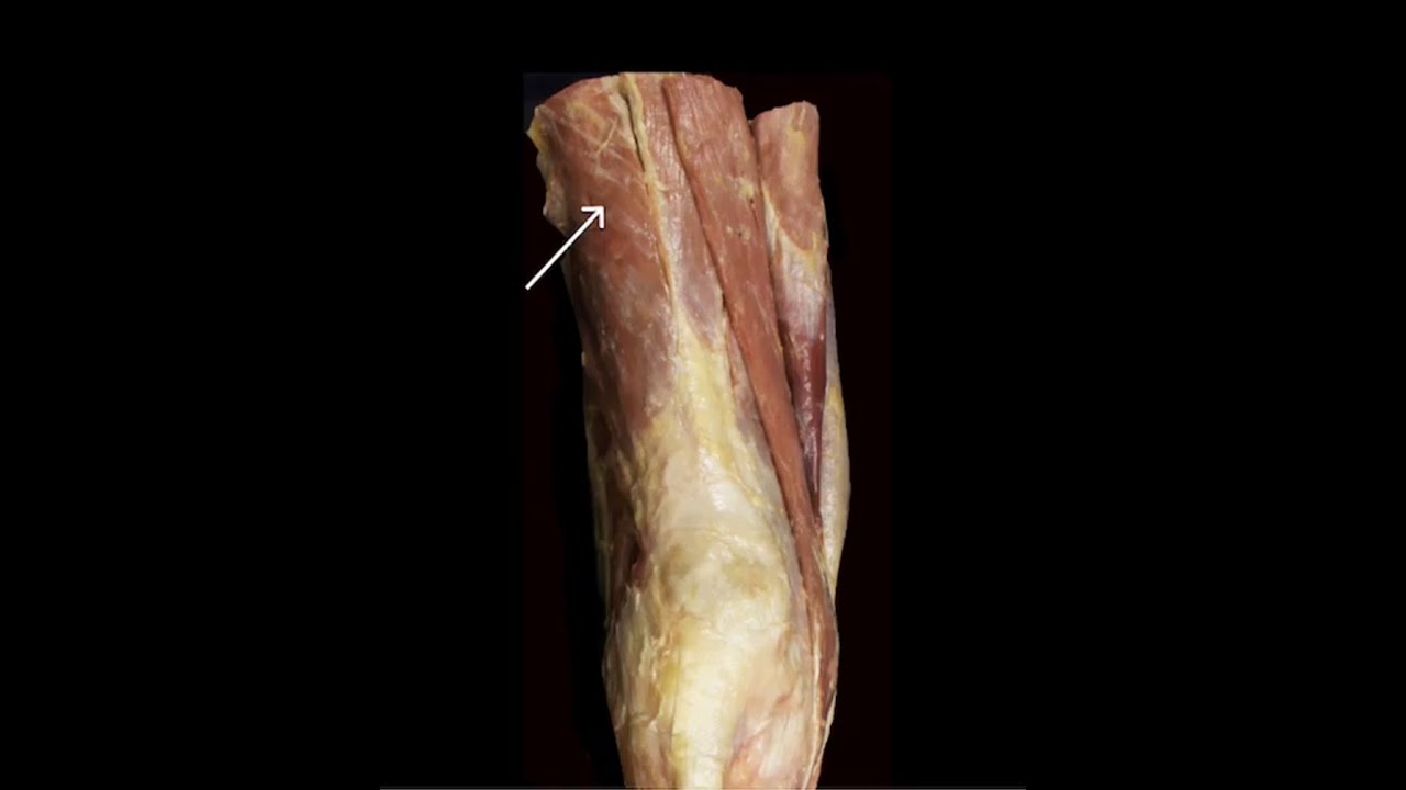 Can you identify this leg structure? | Anatomy of the Lower Limb | Med ...