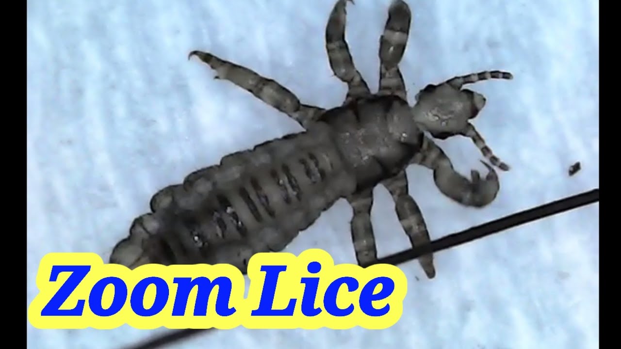 Zoom Lice || Zoom Kutu Rambut || Microscope Digital - YouTube