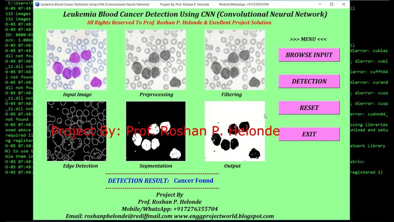 Leukemia Blood Cancer Detection Using CNN With Source Code | Leukemia Detection Using Python ...
