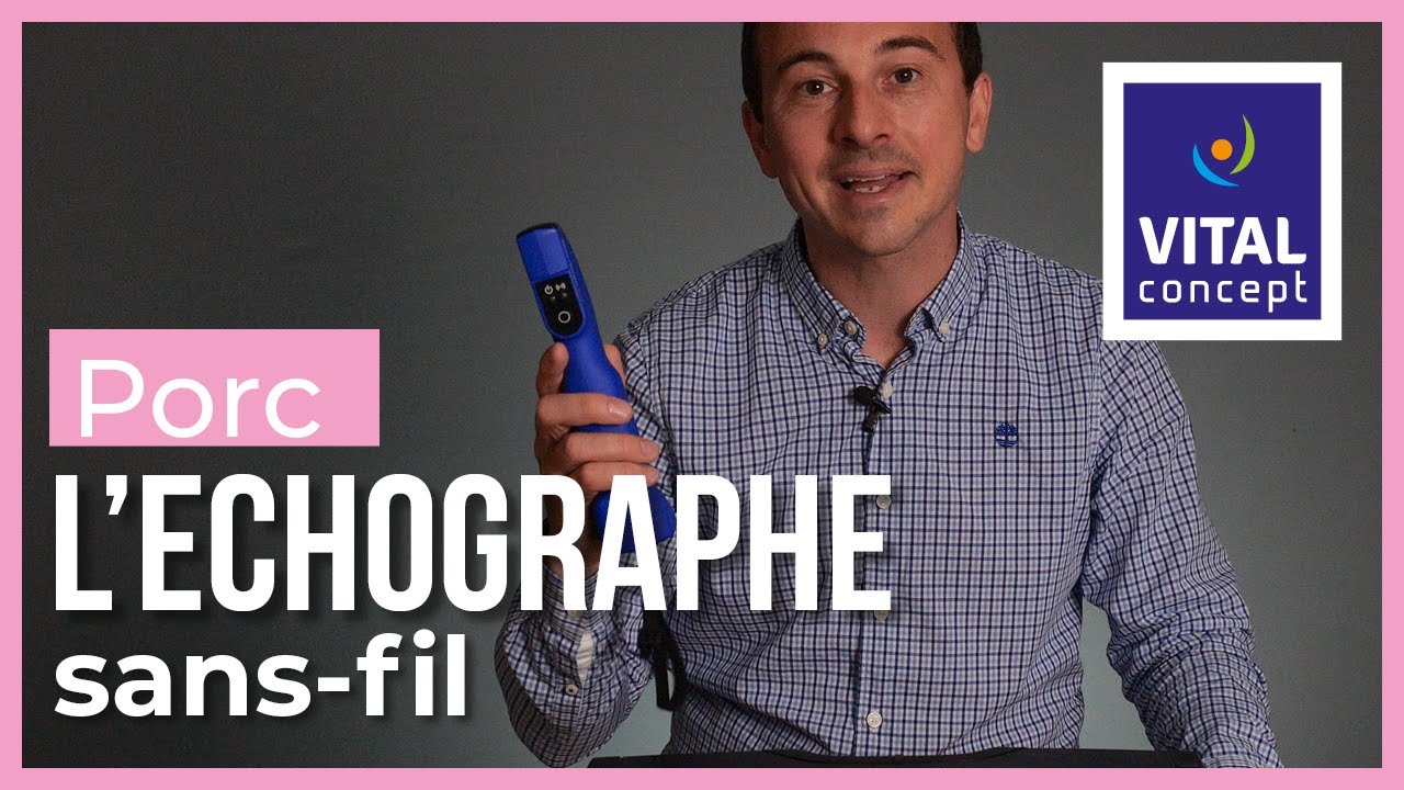 Duo Scan-Go : simplifier l'acte échographique ! - YouTube