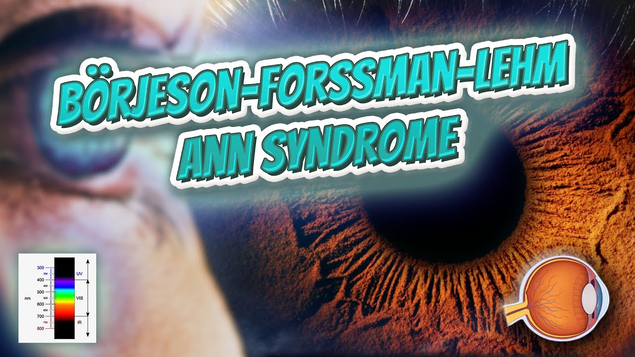 Börjeson Forssman Lehmann syndrome - Your EYEBALLS - EYNTK 👁️💉😳💊🔊💯 ...