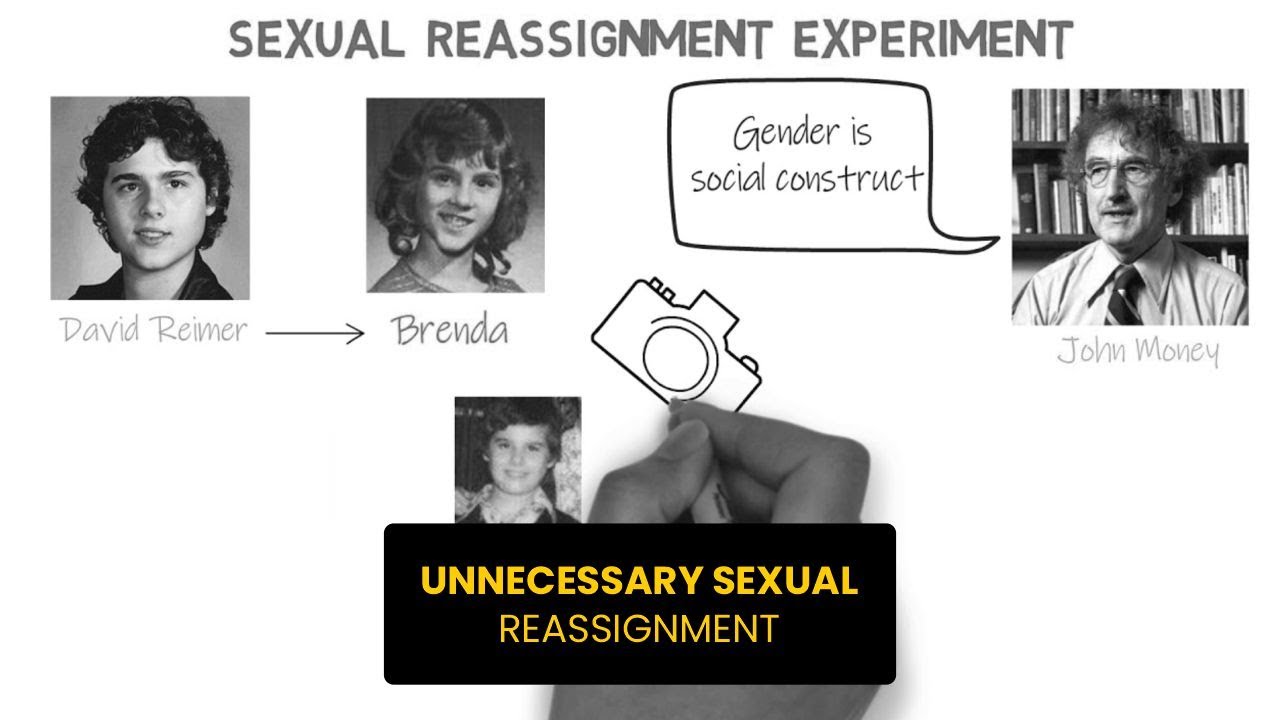 Unnecessary Sexual Reassignment | Surgical Gender reassignment therapy ...
