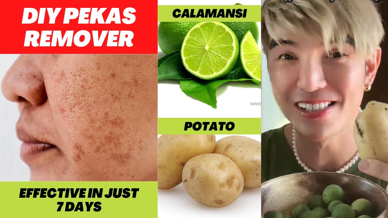DIY PEKAS REMOVER Effective in just 7 Days - YouTube