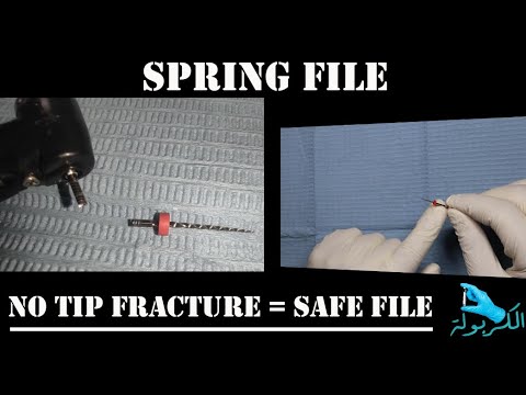 Denflex Spring Endo Files (Safe files) Review - YouTube