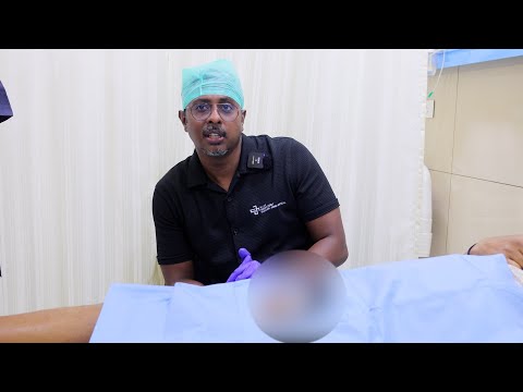 AMS 700 LGX Penile Implant Recovery | Best Results & Healing