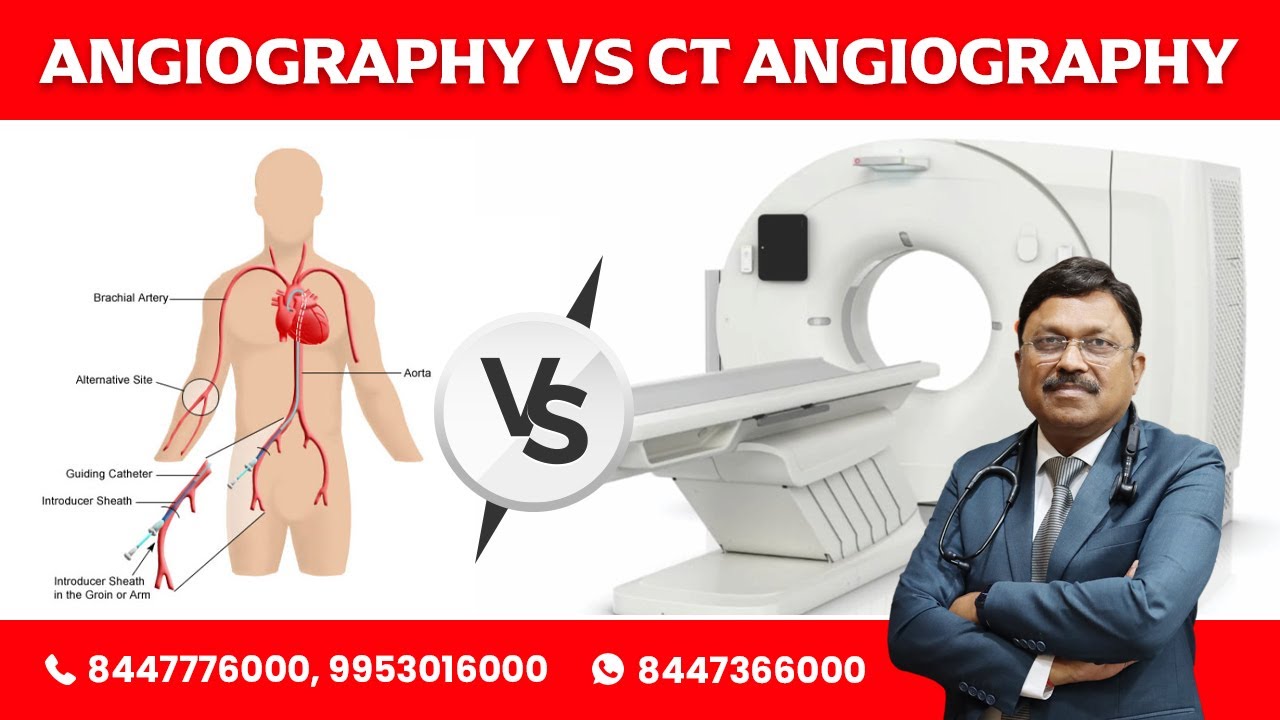 ANGIOGRAPHY VS CT ANGIOGRAPHY | Dr. Bimal Chhajer | Saaol - YouTube