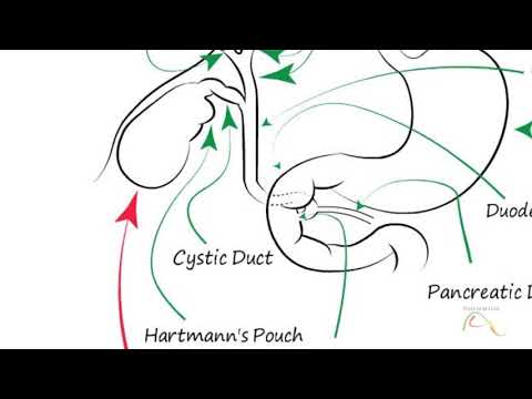 Cholecystitis  -  Part 1 0f 2 - Acute Cholecystitis