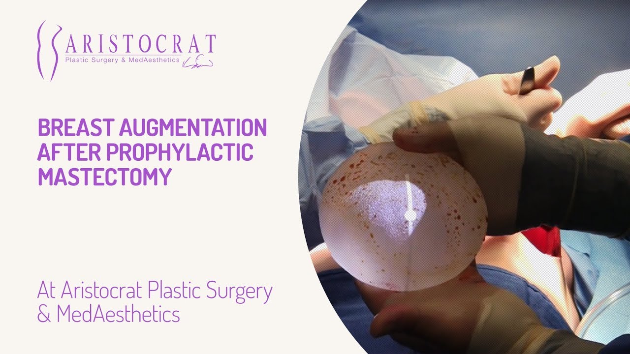 Breast Augmentation after Prophylactic Mastectomy - YouTube