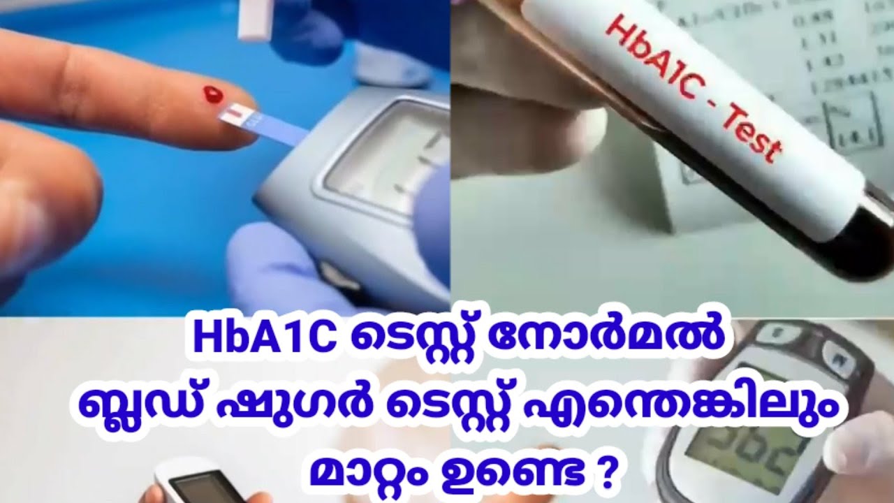 HbA1C test Normal blood sugar test Any change ? | HbA1C टेस्ट ब्लड शुगर ...