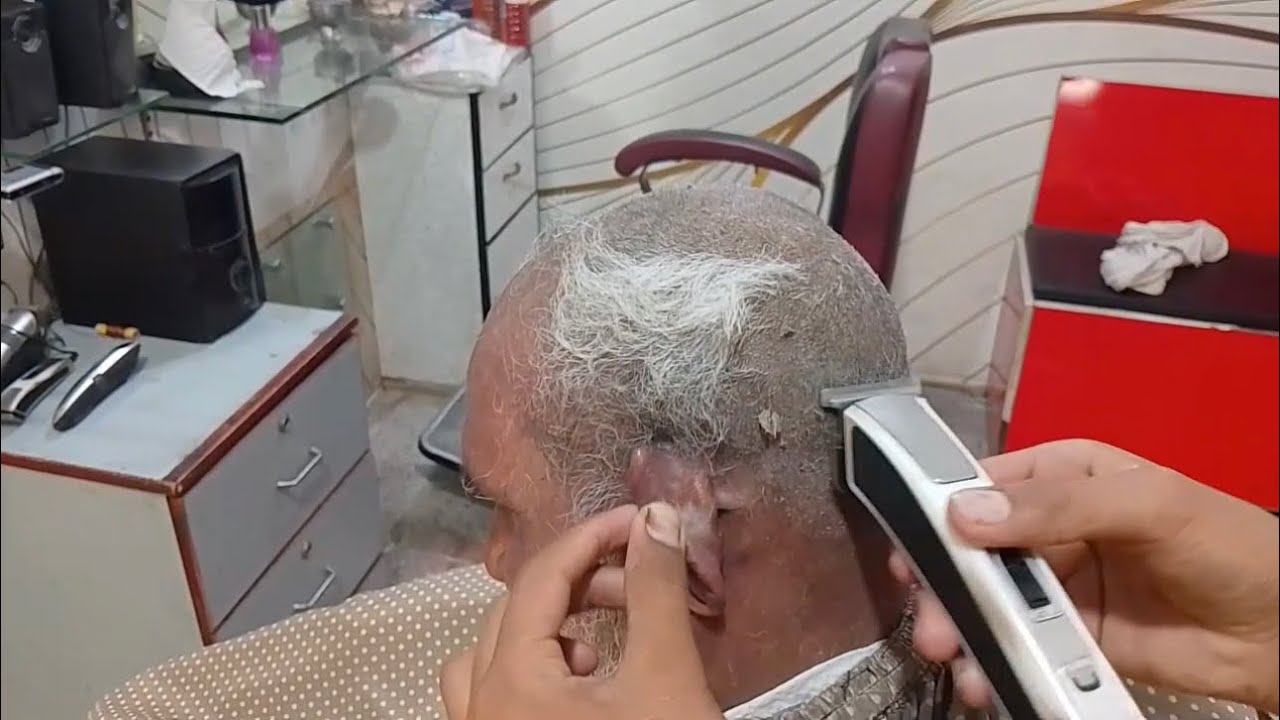 Dandruff completely removed Head shaved before after ||dandruff removal ...