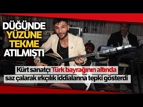 Düğünde Yüzüne Tekme Atılan Müzisyen Erdal Erdoğan İHA'ya Konuştu
