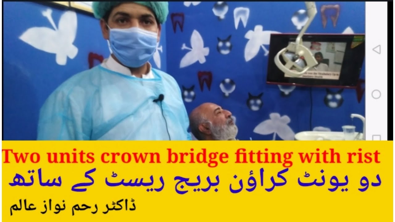 دو یونٹ کراؤن بریج ٹاپ ریسٹ کے ساتھ۔ Two units crown bridge with top ...