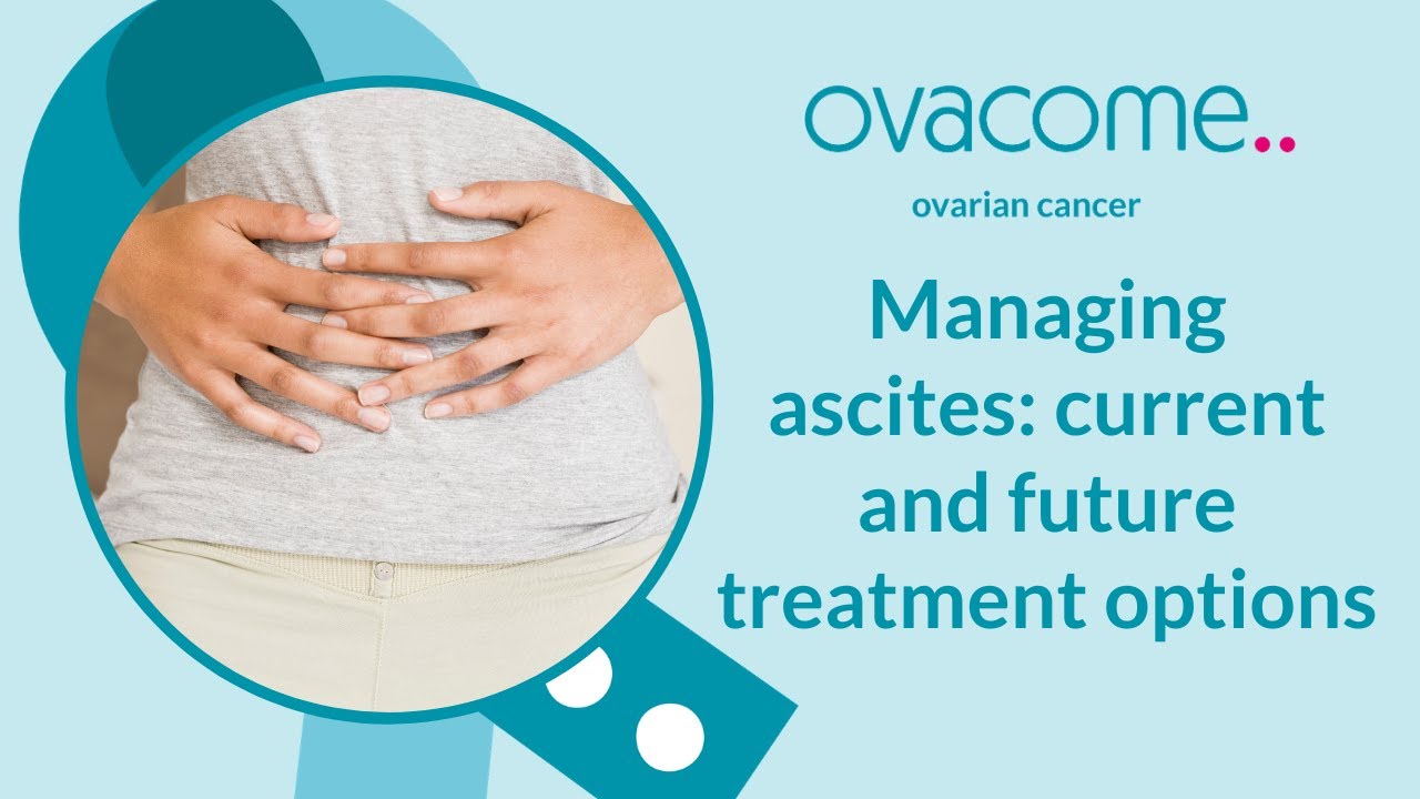 Managing ascites: current and future treatment options - YouTube