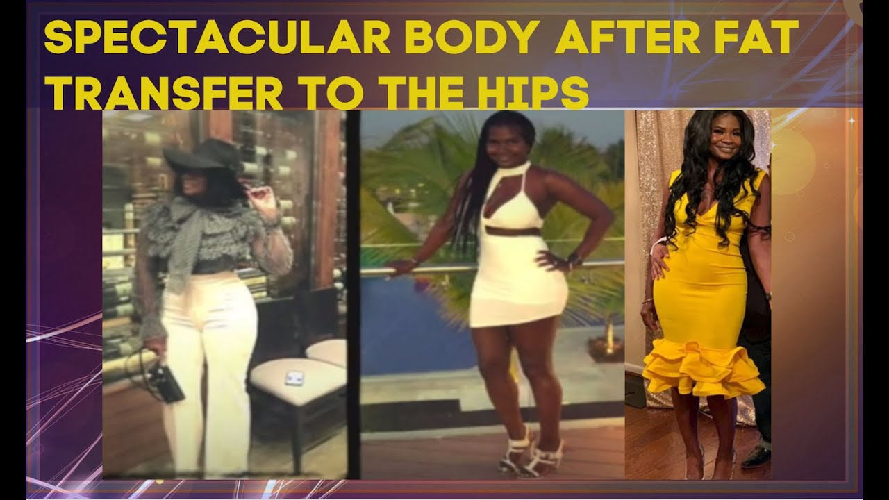 Feels Beautiful With Her Spectacular Body After Hourglass Hips ...