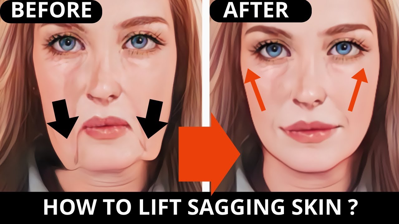 🛑 HOW TO LIFT SAGGING SKIN ? JOWLS, LAUGH LINES, FOREHEAD WRINKLES ...