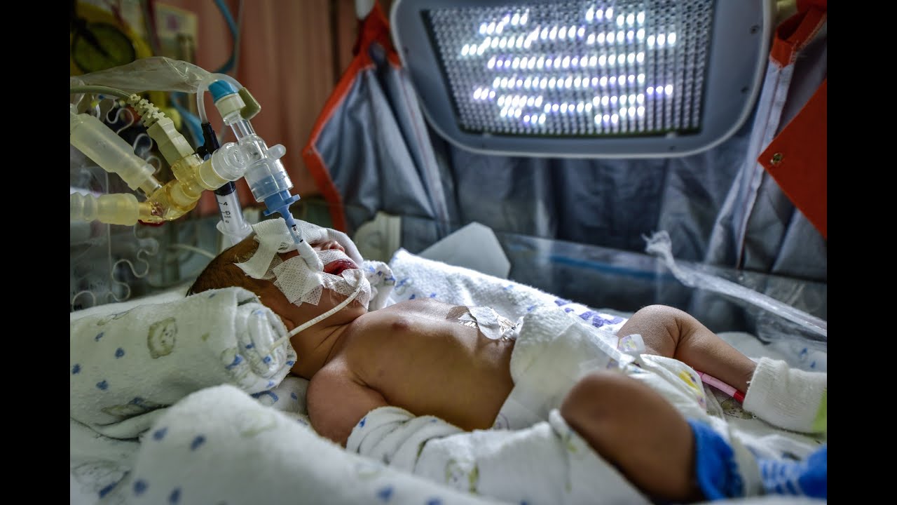Hypoxic Ischemic Encephalopathy (HIE) Follow Up Question For Your Baby ...