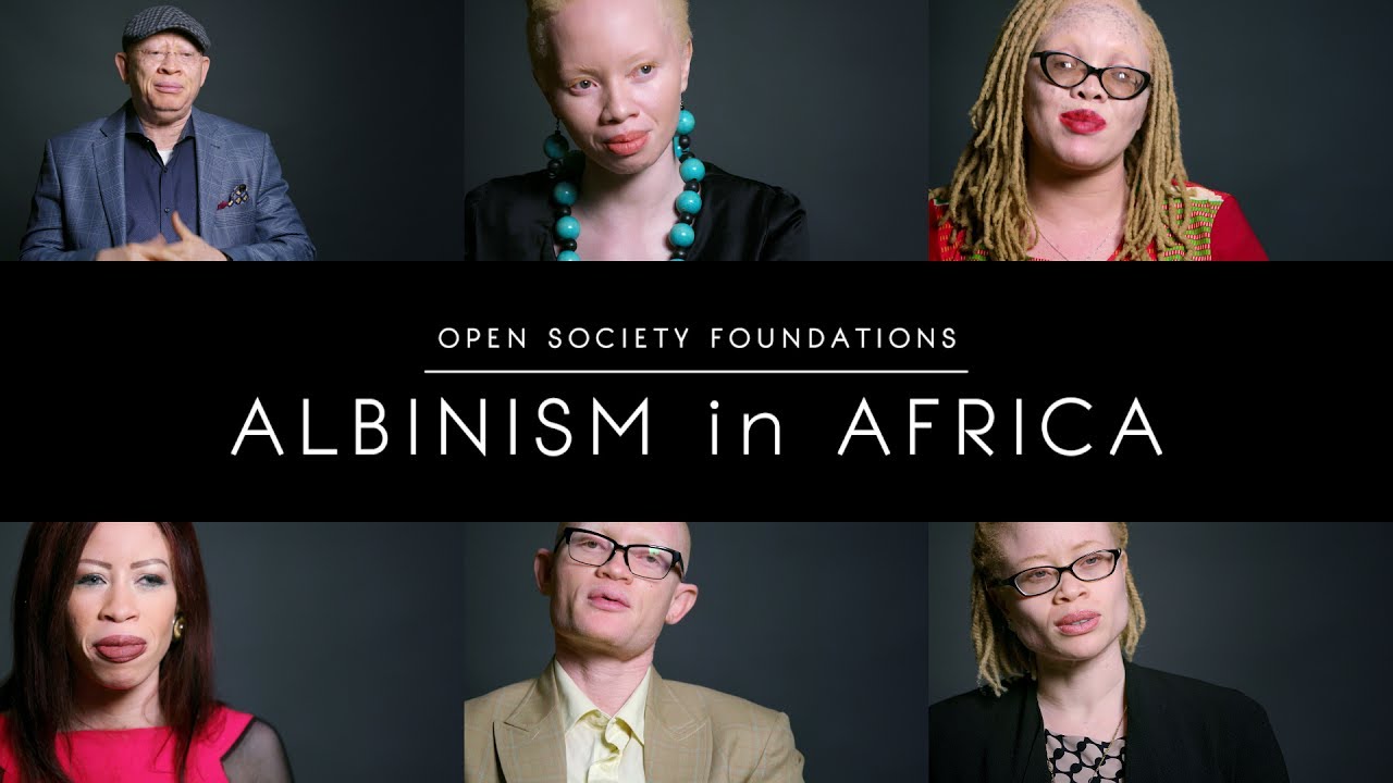 Defending the Human Rights of People with Albinism - YouTube