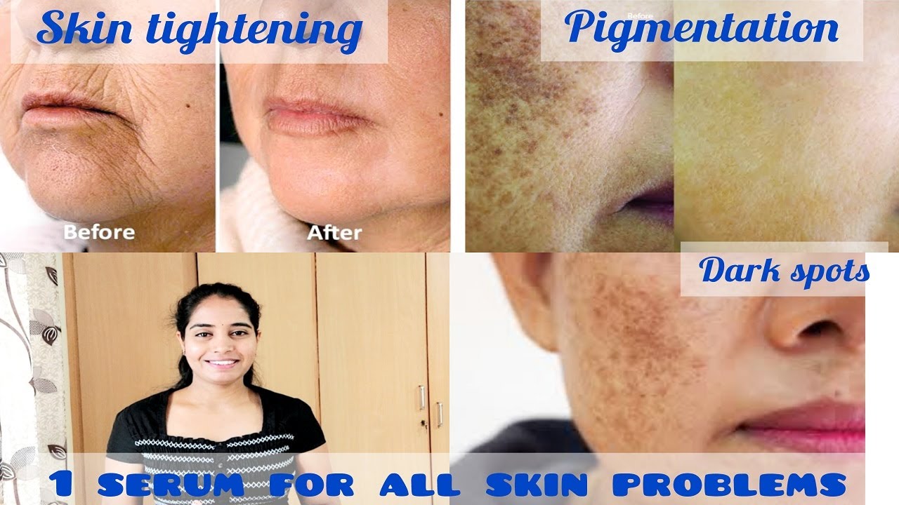 Powerful Face Serum for Pigmentation, dark spots/ one Serum for all ...